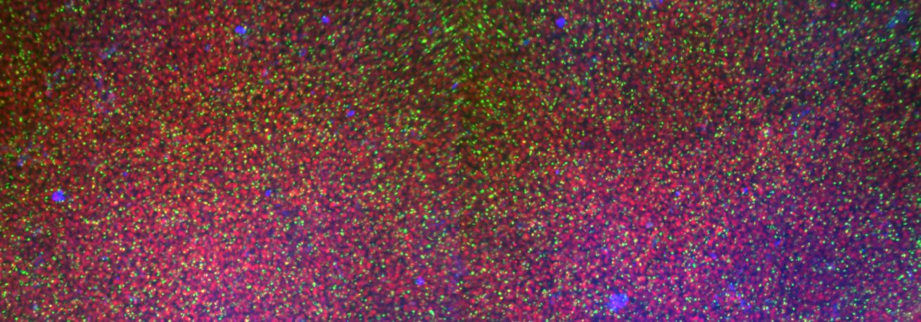 Inflammation and Fibrosis • Mattek - Part of Sartorius