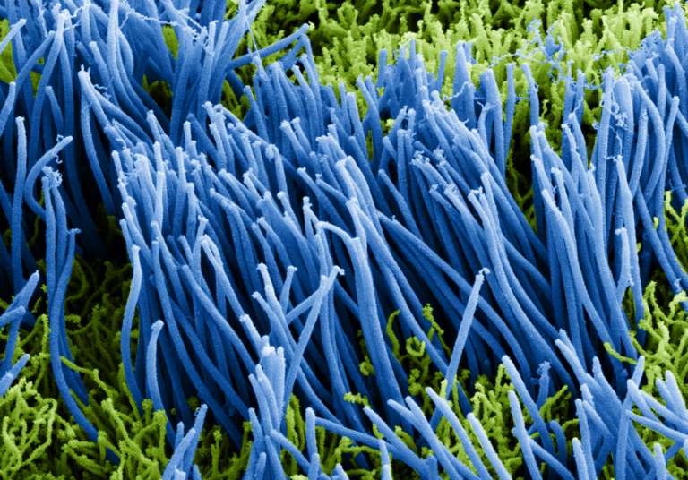 Lung Cell Culture Models • MatTek Life Sciences