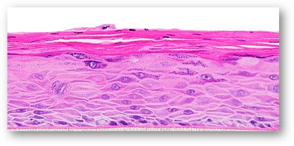 Oral Irritation (Buccal & Gingival) | MatTek Corporation