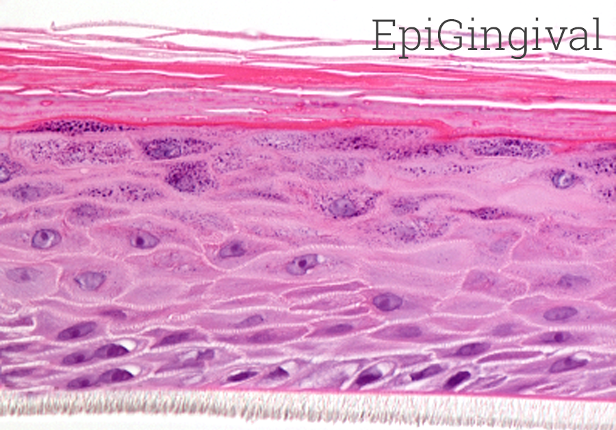 EpiOral and EpiGingival in vitro 3D Tissues | MatTek Life Sciences