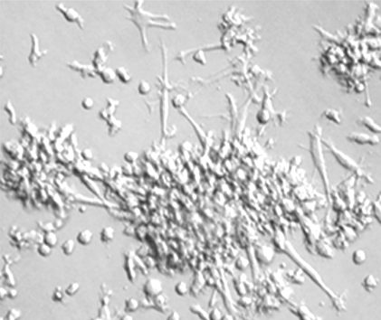 Human Dendritic Immune Cells | Mattek - Part of Sartorius